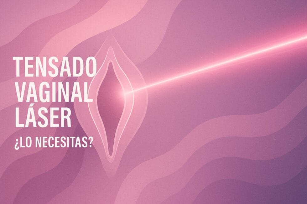 Tensado vaginal con láser en Quito